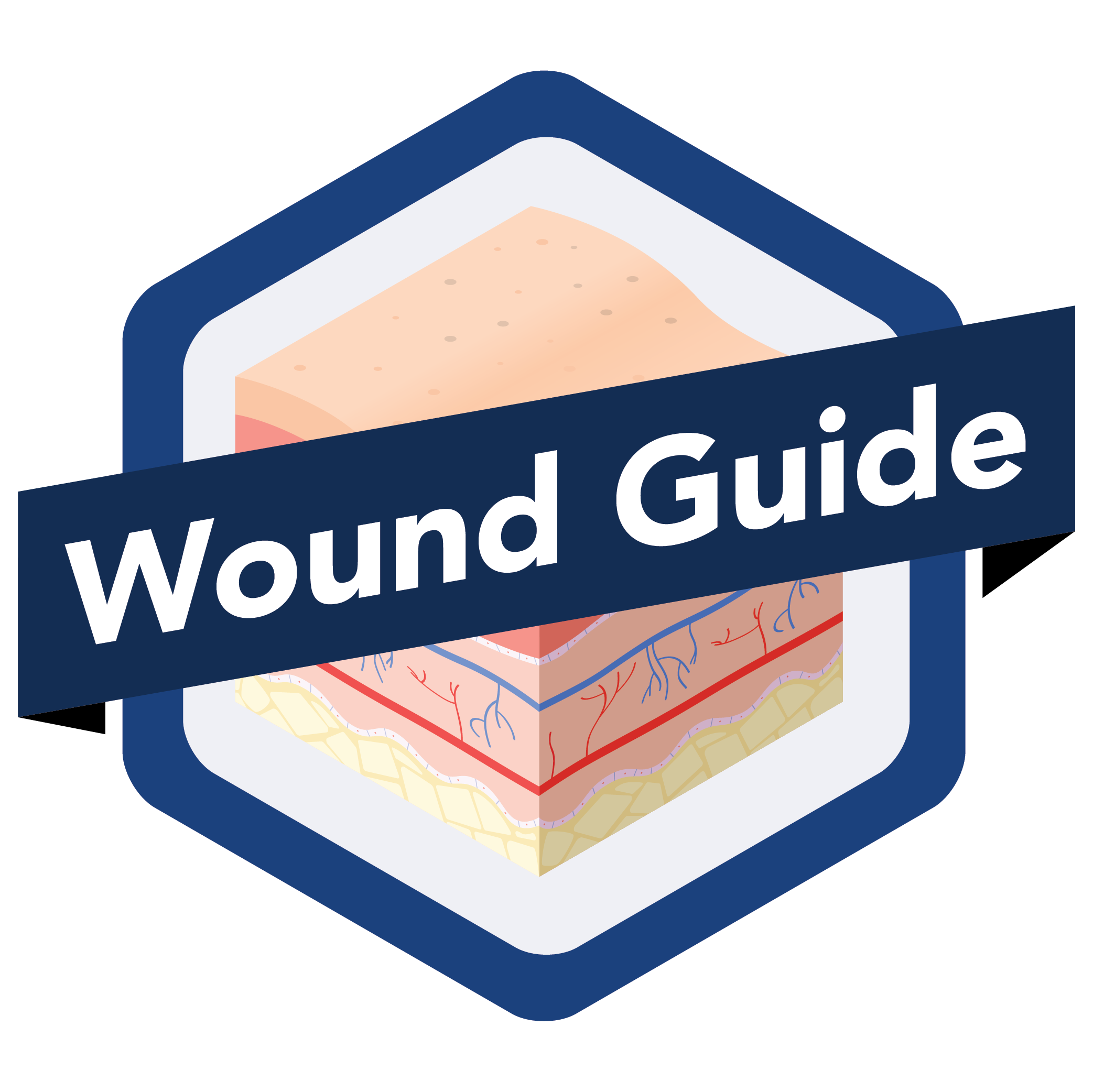 Wound Guide - Sloughy – Advancis Medical