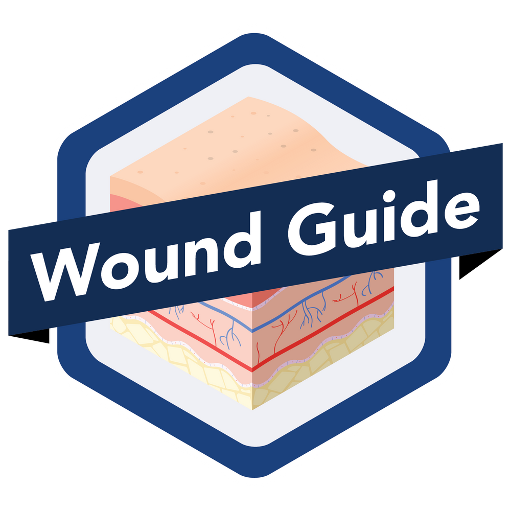 Wound Guide - Sloughy – Advancis Medical